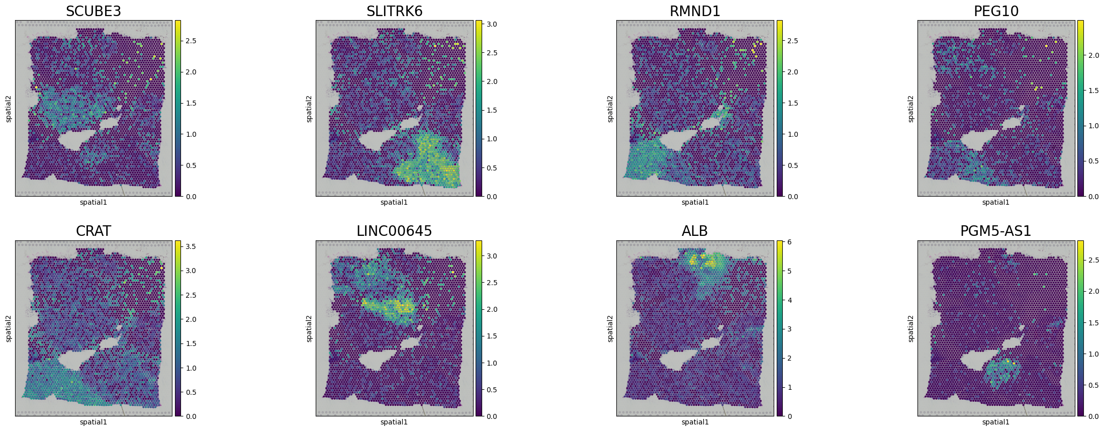 Human breast cancer dataset — DeepGFT v0.0.1 documentation